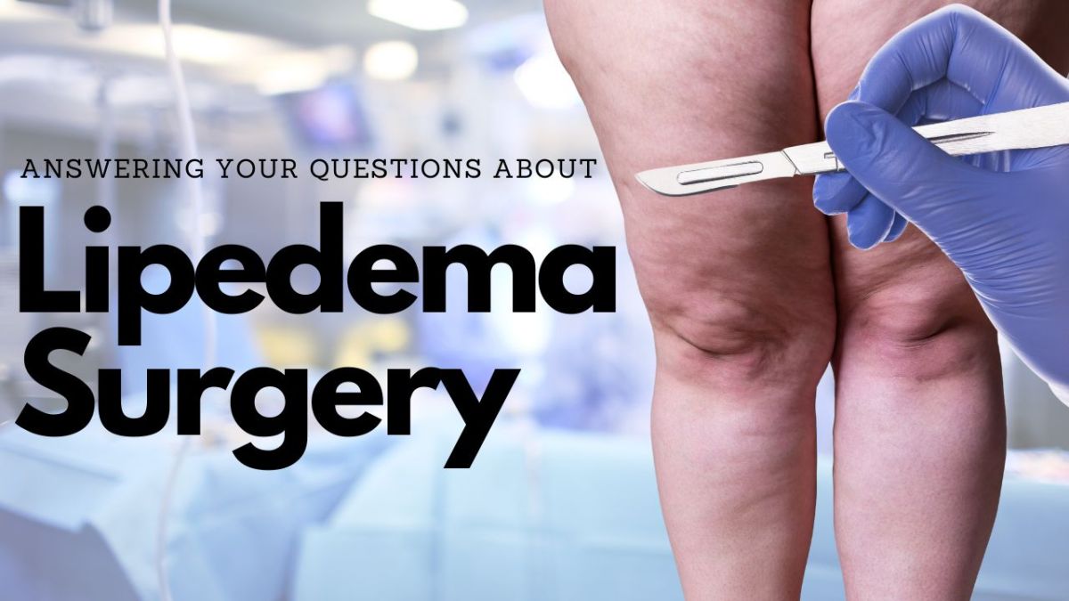 Lipedema Surgery – Sturdy Woman